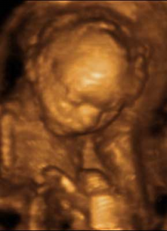 Gestantes Humanizadas: 16º Semanas